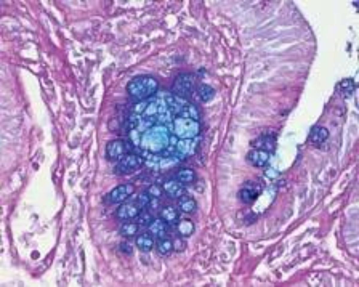 阿利辛蓝-过碘酸雪夫氏染色（AB-PAS） - 学习笔记-FZBL.TOP