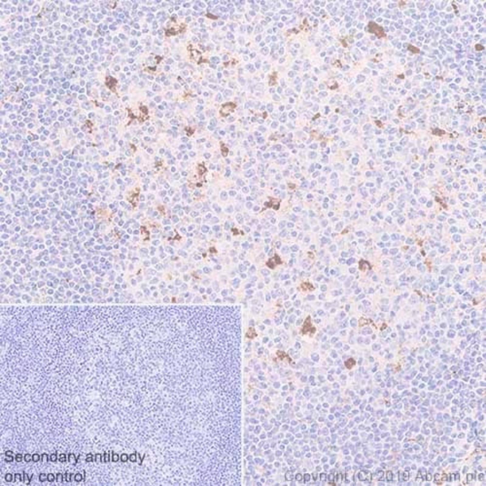 CD68 - 学习笔记-FZBL.TOP