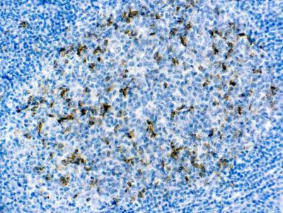 CD57 - 学习笔记-FZBL.TOP